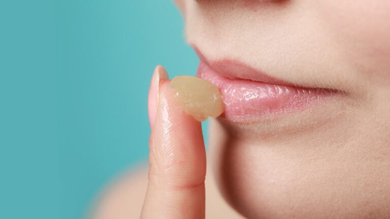 Qué significa tener los labios secos y agrietados: causas y remedios ...